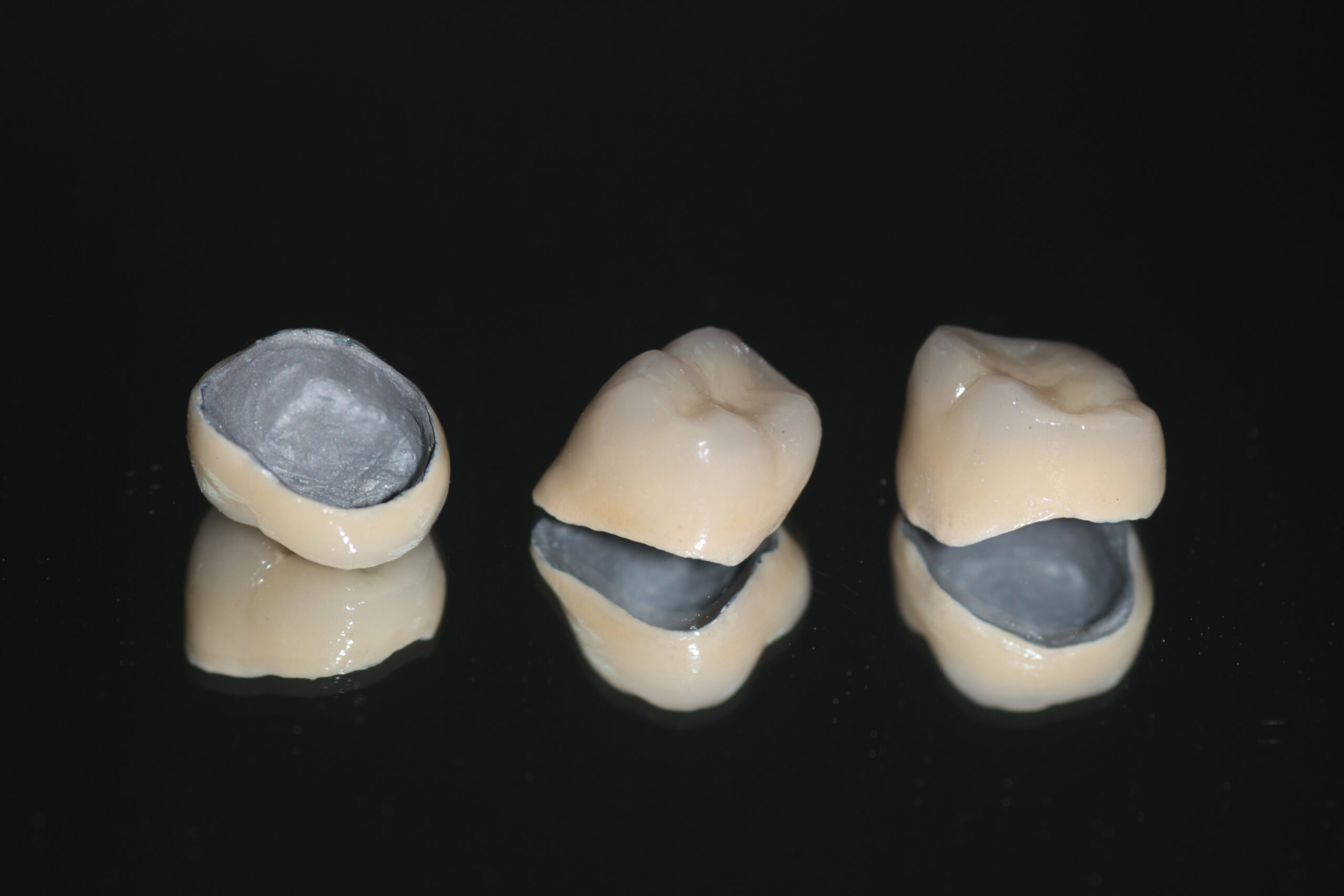 Placing A Custom Dental Crown | Fort Bliss, TX